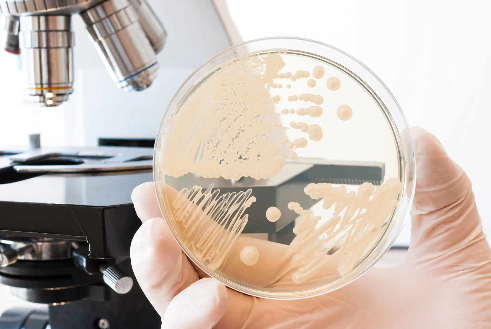 SIFO: The Definitive Guide to Small Intestinal Fungal Overgrowth